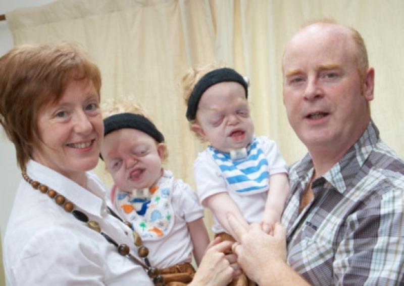 HSE to meet with Leixlip family over care of twins - Kildare Live